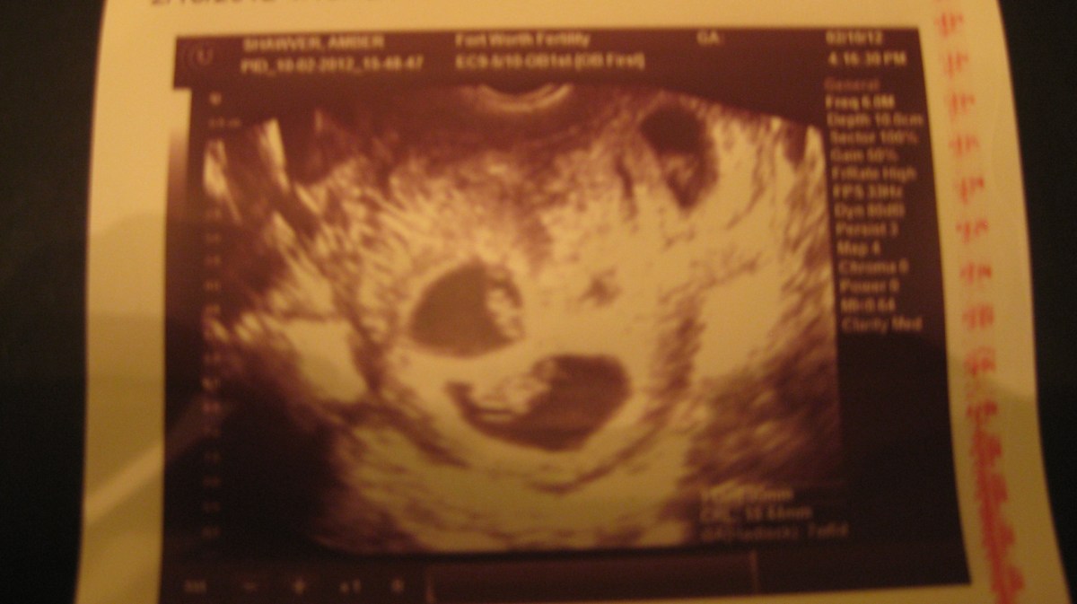 Ultrasound #2 – Four to Adore